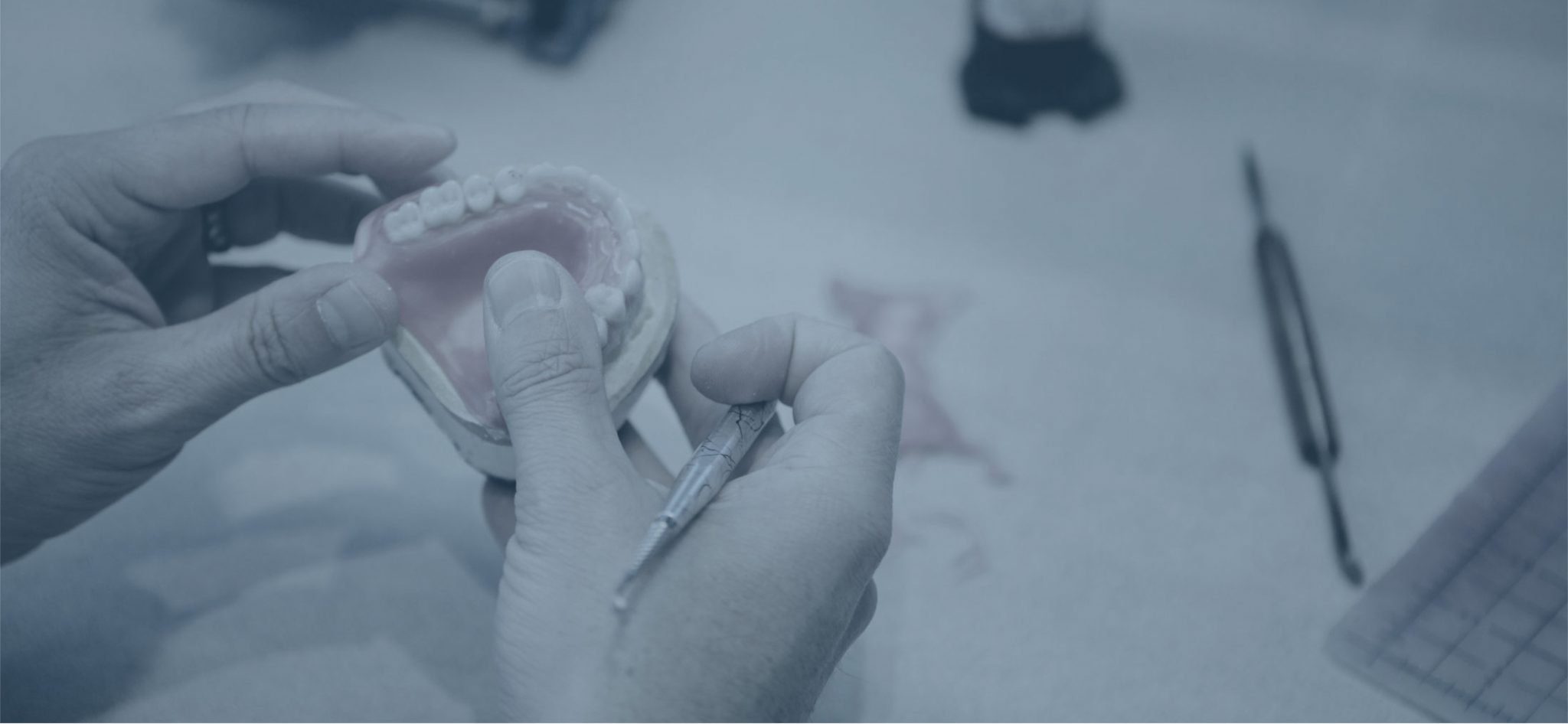Dentures & Orthodontics | FAQs | ORTHOtech Dental Lab